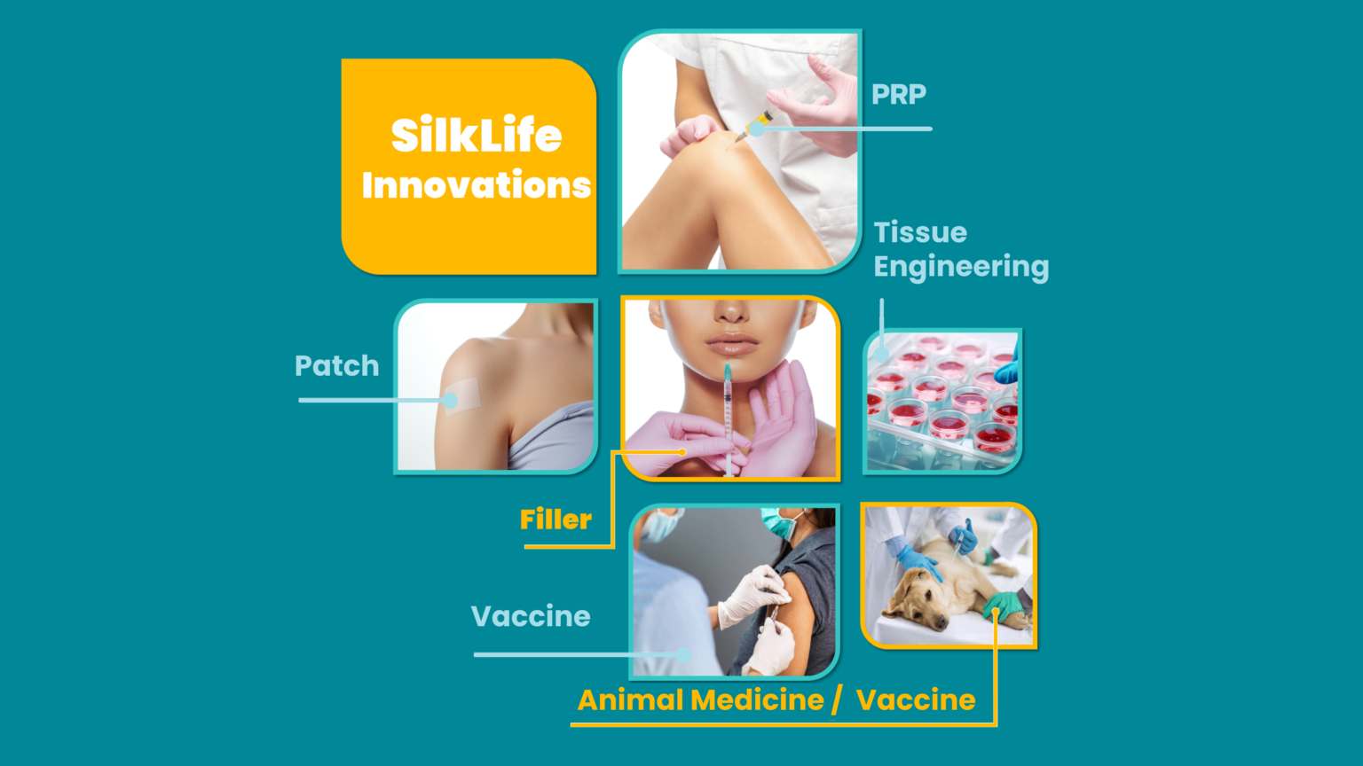SilkLife - EngineLife